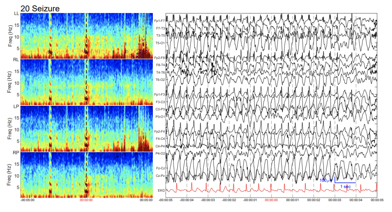 [2412.07878] Comparative Analysis of Deep Learning Approaches for ...