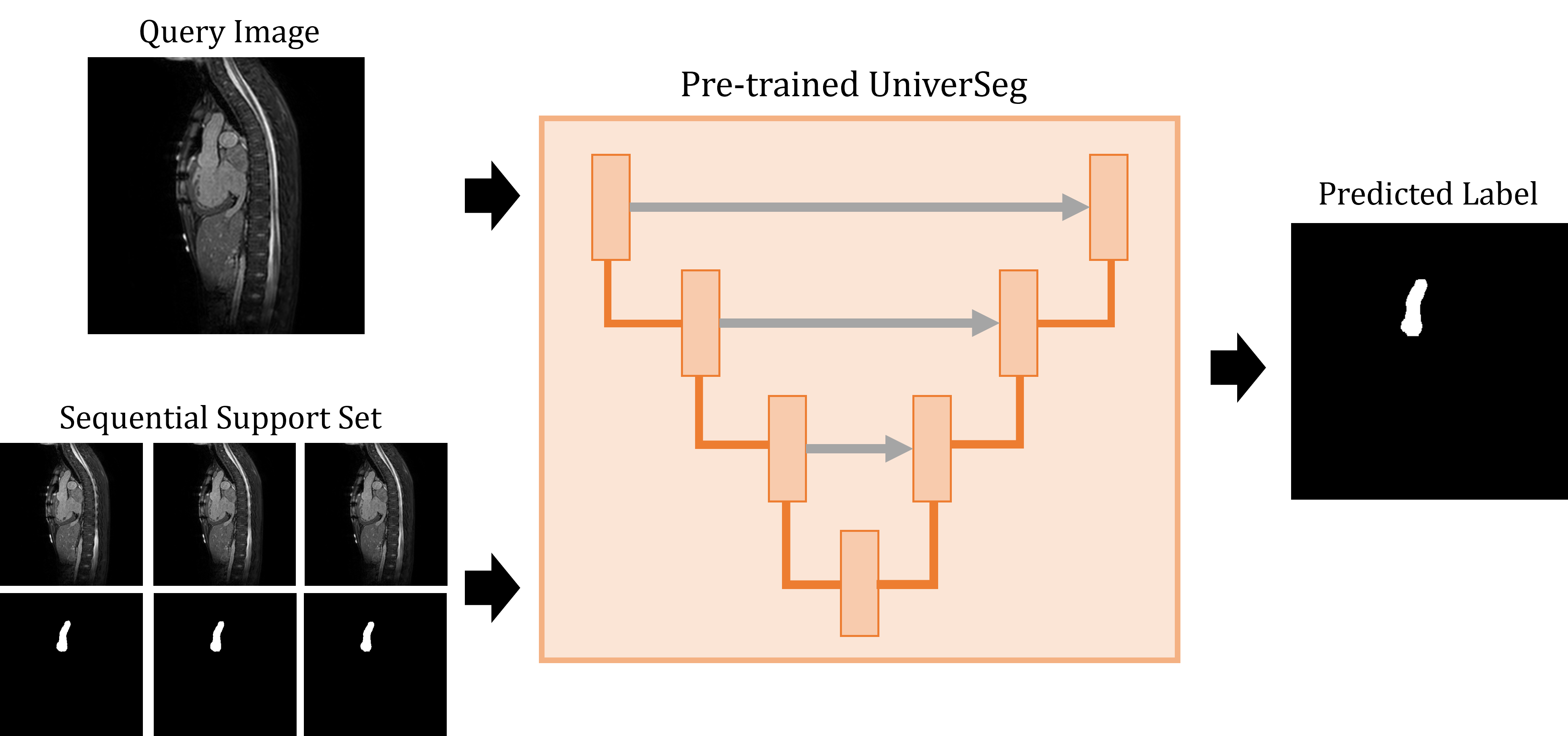 [2412.13299] In-context learning for medical image segmentation ...