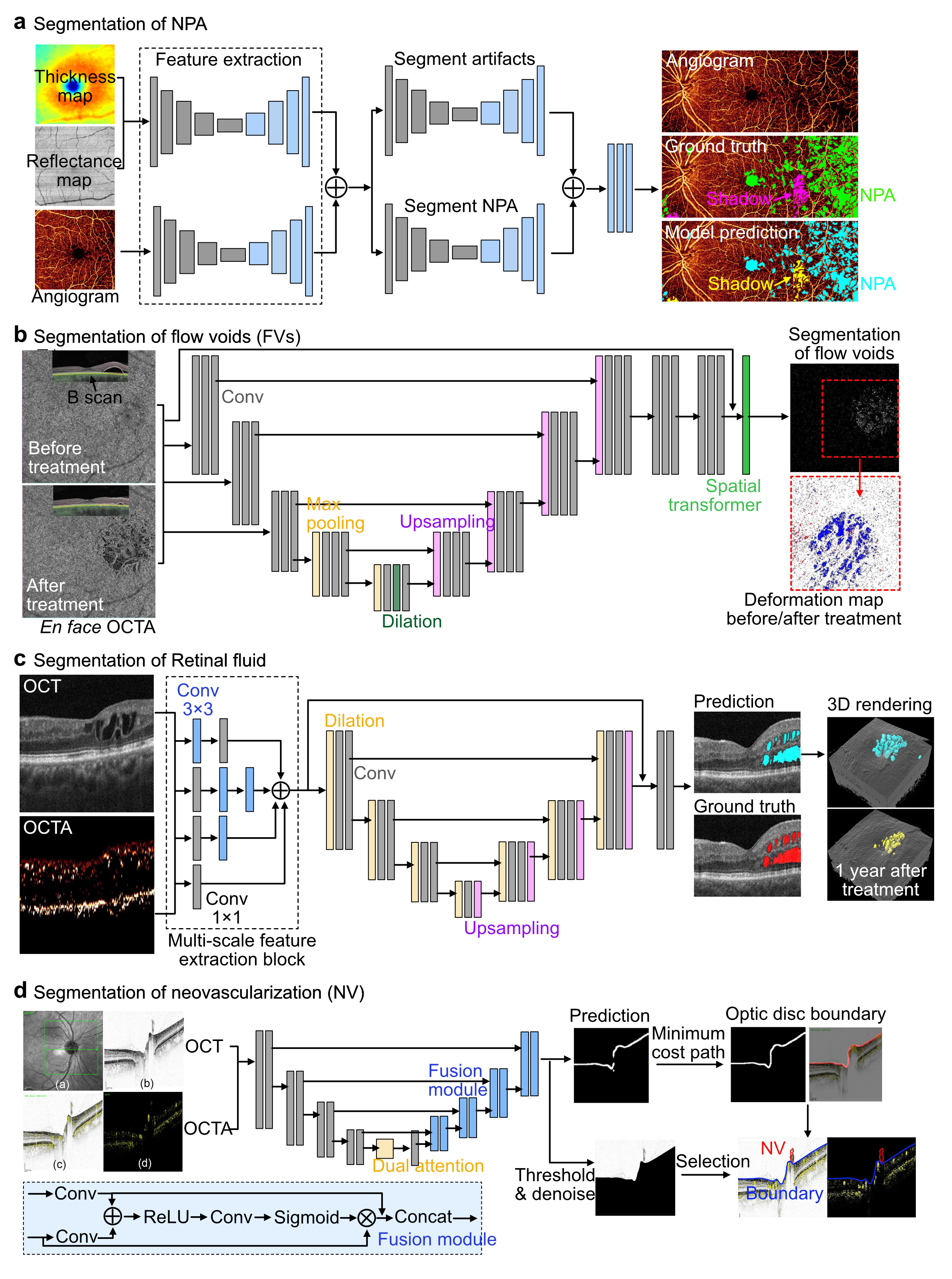 [2502.14935] Denoising, segmentation and volumetric rendering of ...