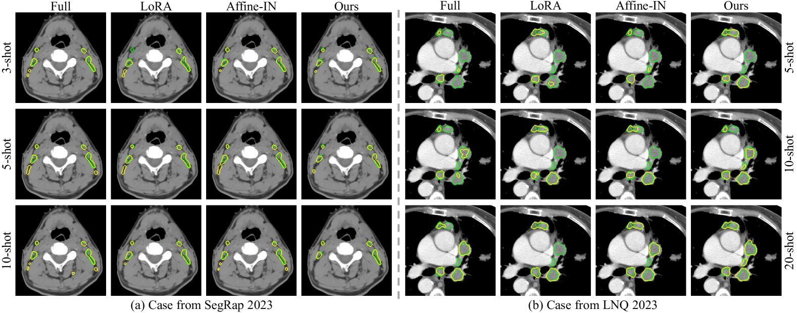 [2503.00748] Dynamic Gradient Sparsification Training for Few-Shot Fine ...